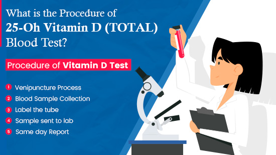 Book Vitamin D (25-OH) Test in Chennai & Get 60% Discount on Price